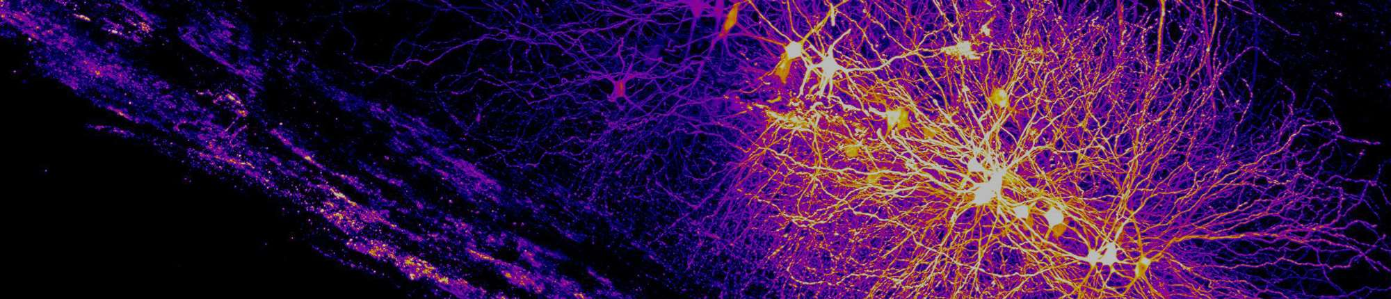 Neural Engineering & Modulation Lab | Medical College of Wisconsin