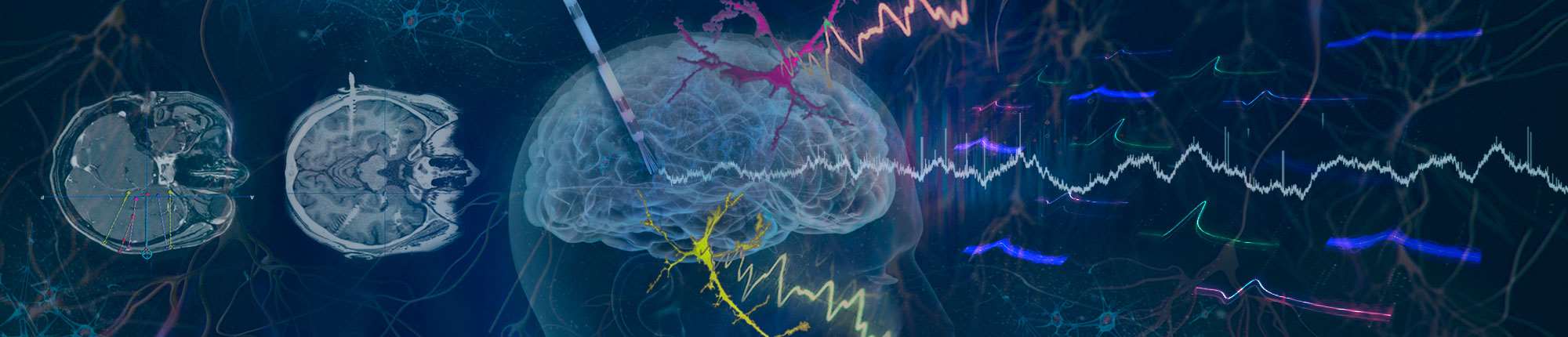 ReyLab | Neurosurgery Research | Medical College of Wisconsin