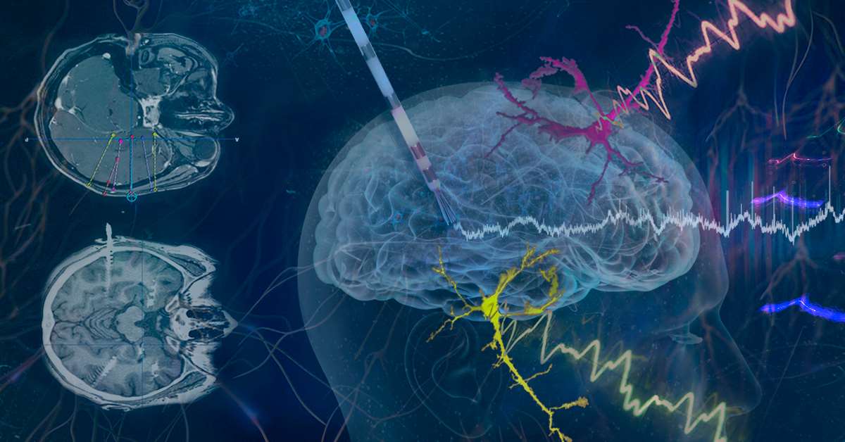 ReyLab | Neurosurgery Research | Medical College of Wisconsin