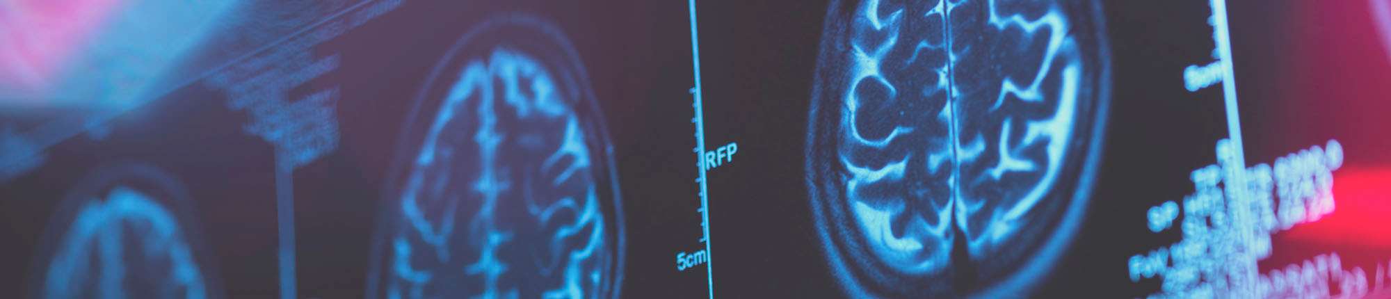 Neurology | Medical College of Wisconsin