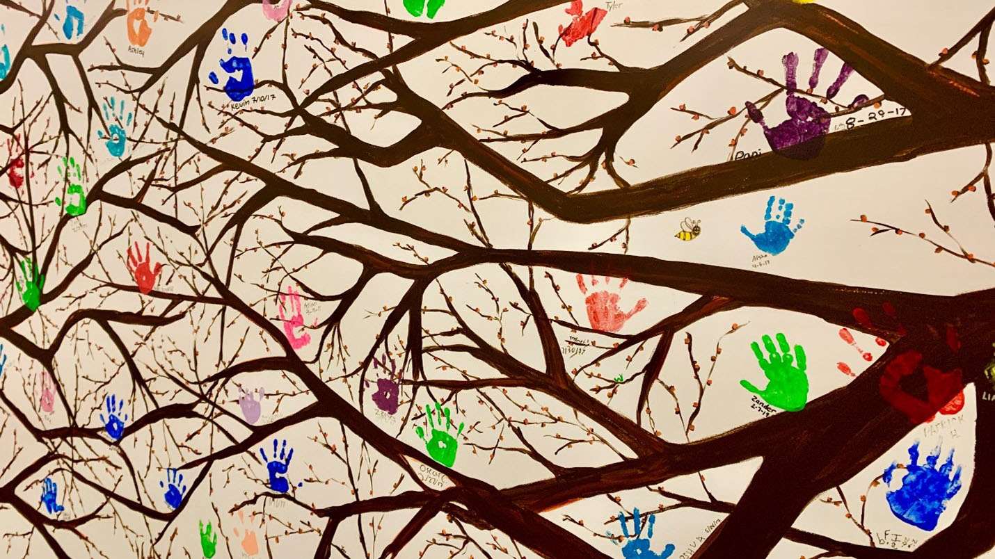 Hand Surgery Fellowship | Plastic Surgery | Medical College of Wisconsin